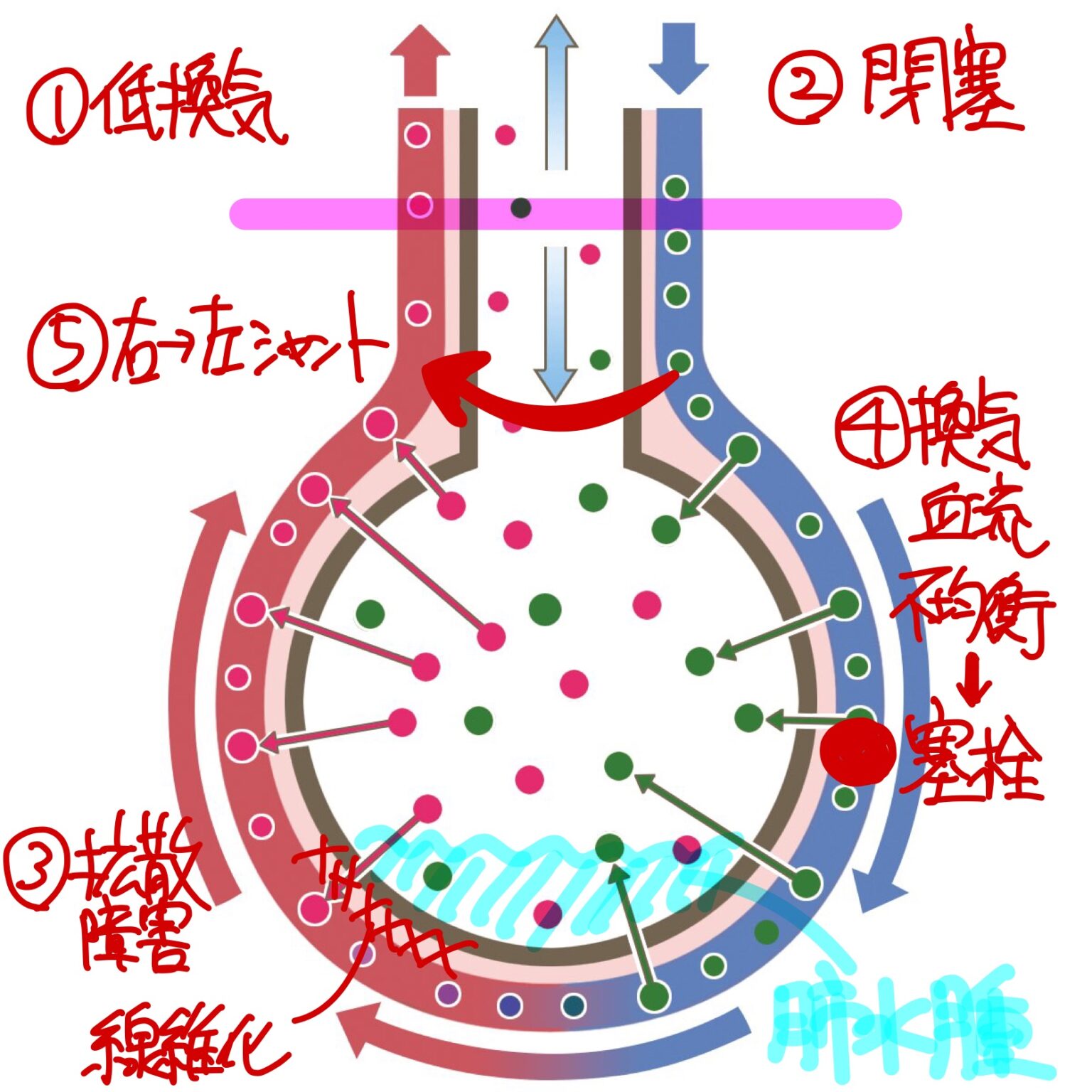 血液ガス・酸塩基平衡障害 | くすり～の